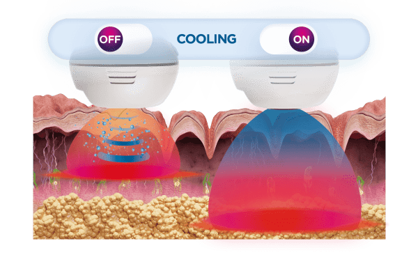 Exion 4 in 1: Endless Possibilities - Allure Laser Skin and Aesthetic ...