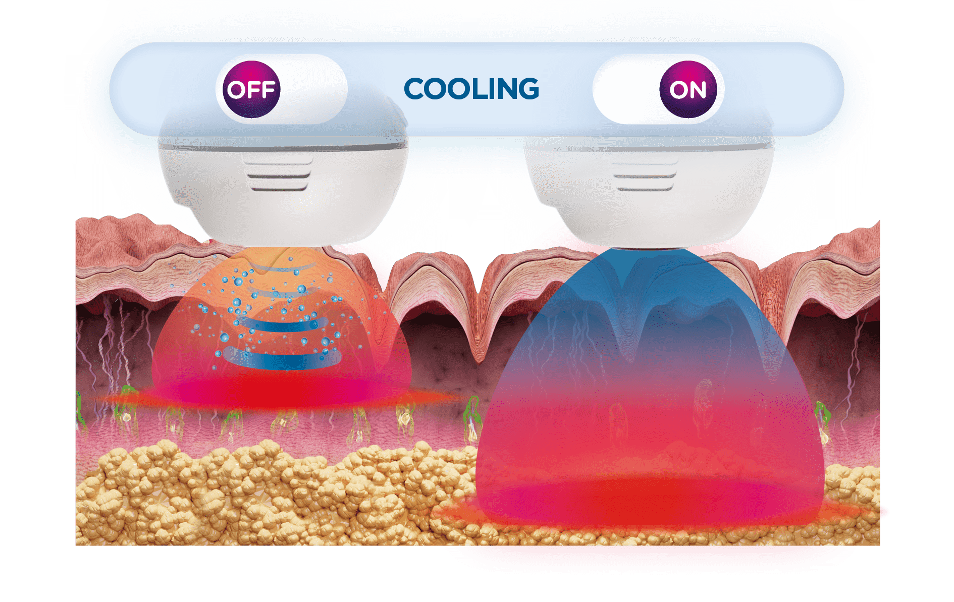 Exion 4 in 1: Endless Possibilities - Allure Laser Skin and Aesthetic ...