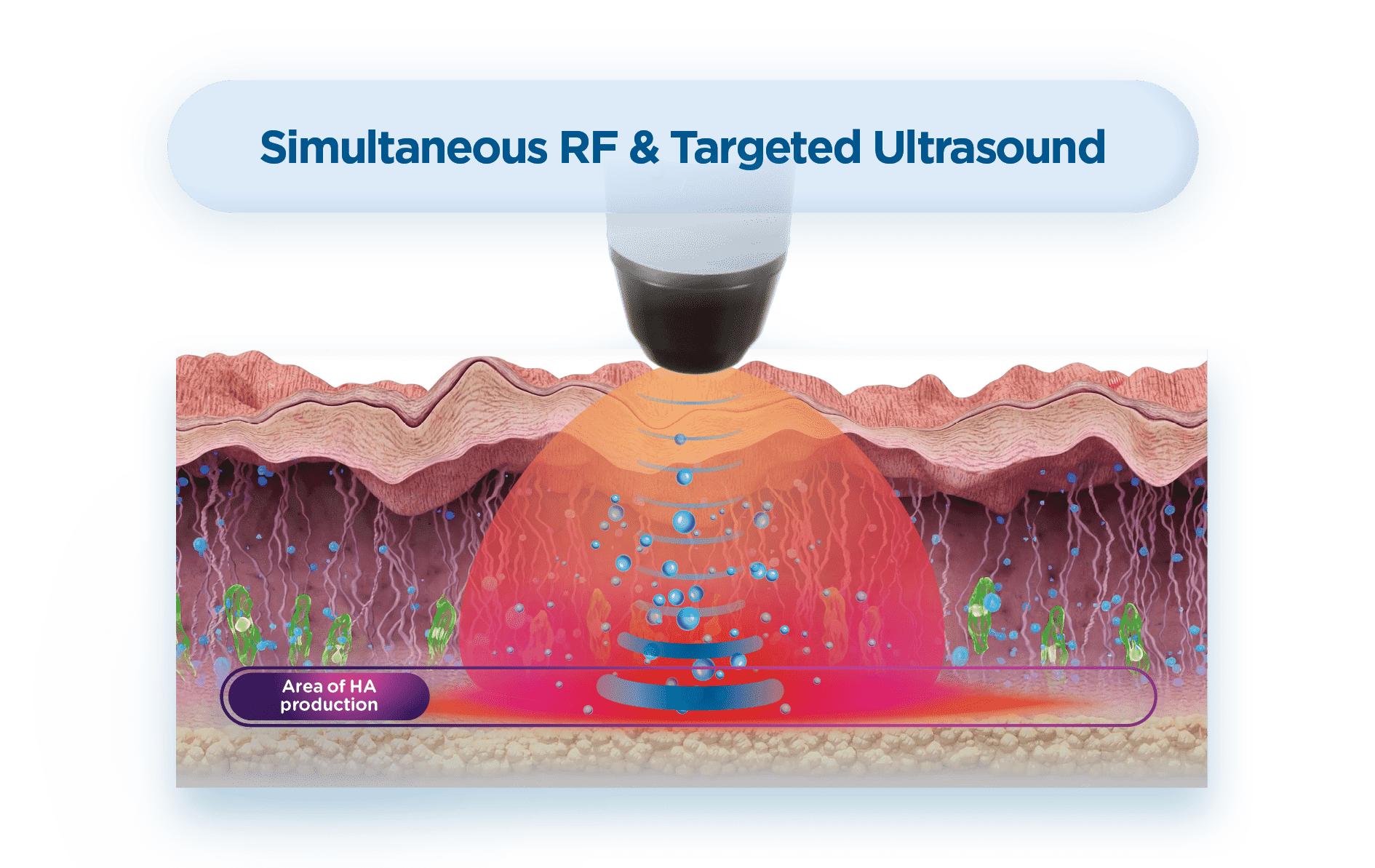 Exion 4 in 1: Endless Possibilities - Allure Laser Skin and Aesthetic ...