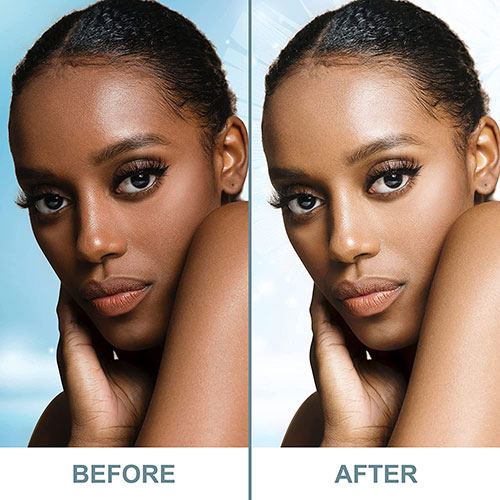 Glutathione Injection Before And After Glutathione Injection For Skin