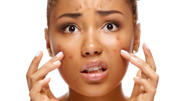 Post-Inflammatory Hyperpigmentation (PIH) Treatment Guide: Achieve ...